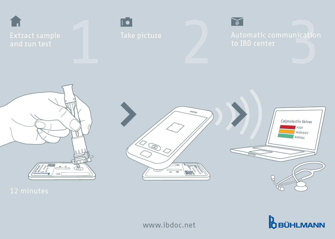 BÜHLMANN launches calprotectin IBDoc®, the first CE marked patient home ...